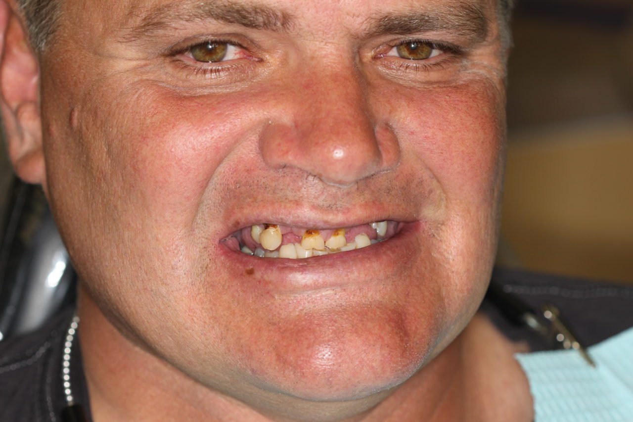 Smile Gallery | Waterloo Dental Associates | Waterloo, IA